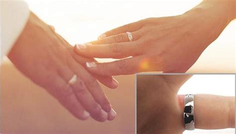 Everything You Must Know About Engagement Or Wedding Ring Allergy