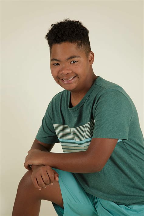 Luke T Zbd Talent Models With Disabilities Visible Differences