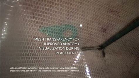 Symbotex Composite Mesh Lap Ventral Hernia Repair Porcine Model