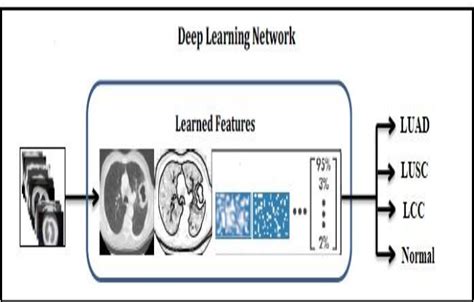 Figure 3 From Detection And Classification Of Lung Nodule In Ct Scan