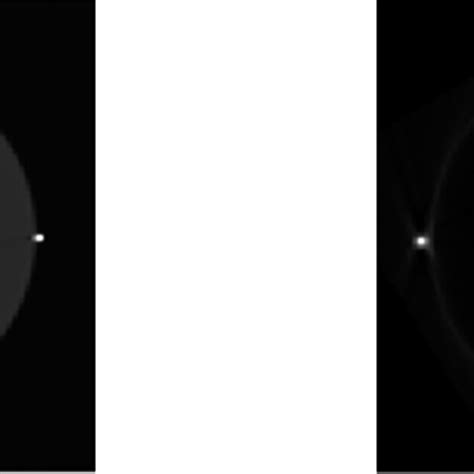 Schematic Diagram Of The Developed Algorithm For Automatic Fiducial Download Scientific Diagram
