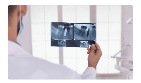 Prótese Protocolo H Odontologia Prótese Protocolo