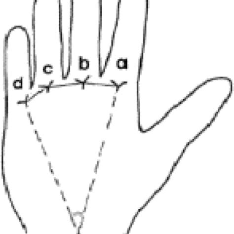 Dermatoglyphic Pattern Distribution In Cases And Controls Download Scientific Diagram