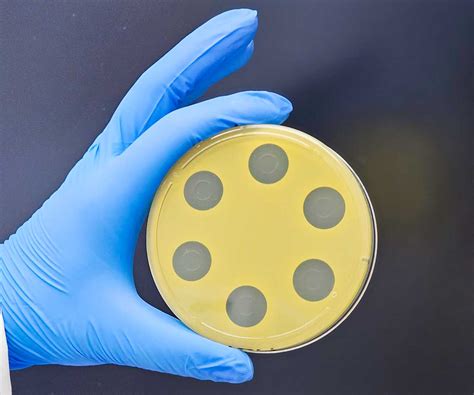 Antibiotic Potency Testing Usp Testing Method