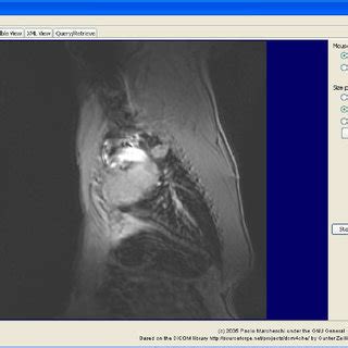 The DICOM Query Retrieve Tool In Action This Viewer Is Based On The Download Scientific Diagram