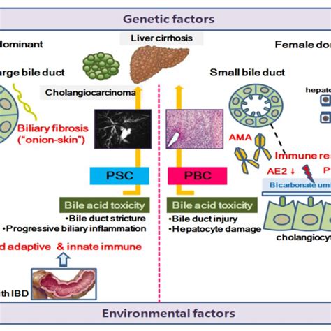 The Comparison Between Pbc And Psc This Is A Figure Highlighting The Download Scientific
