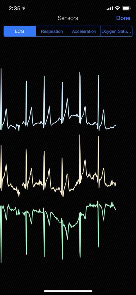 Ai Gets Your Heartbeat Episode 2 Apps And Algorithms In Rhythm