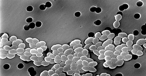 Under The Microscope The Eskape Pathogens Features The Microbiologist