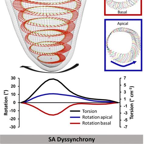 Cardiac Magnetic Resonance Feature Tracking Based Rotational Rotational