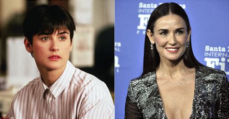 Famosos víctimas del botox Revista Clase