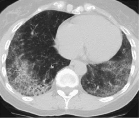 Nsip Nsip Nsip Added A New Photo