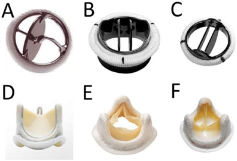 Prosthetic Heart Valves Circulation 42 Off