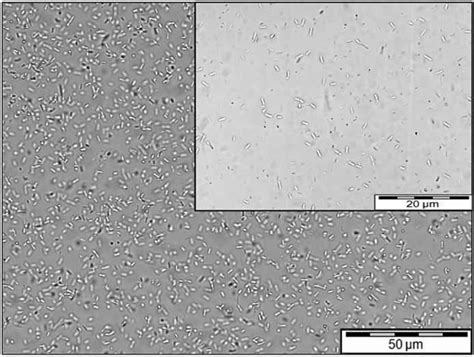 Microscopic Image Of E Coli Cell Magnification 20x And 40x