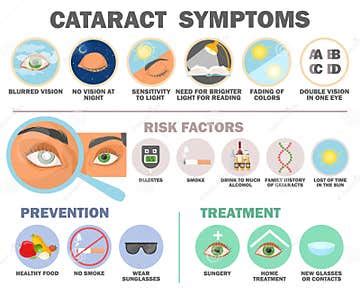 Cataract Symptom Risk Factor Prevention And Treatment Infographic Poster Stock Illustration