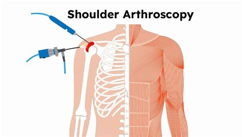 Shoulder Arthroscopy Surgeon In Ahmedabad Dr Samip Sheth