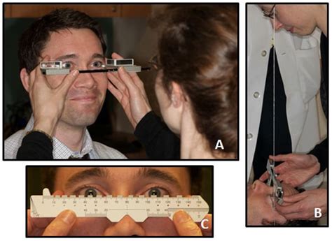 A Clinical Exophthalmometry Patient Upright B Clinical Download