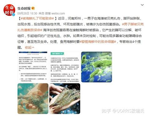 如果在家处理水产品时受伤，如何自行预防海洋创伤弧菌感染？ 知乎