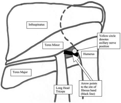 Quadrangular Space Wikism Sports Medicine Wiki