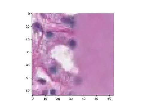 Poor Inpainting Performance When Inpaint Resample Times 1 Issue