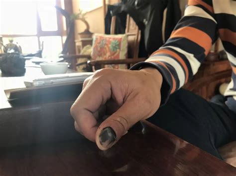 黑指甲是什么症状图片 哪种指甲是症 哪种指甲是症看图片 大山谷图库