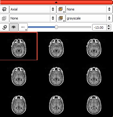Documentation Developers Imagegallery Slicer Wiki