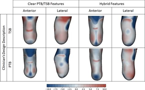 Frontiers Insights Into The Spectrum Of Transtibial Prosthetic Socket