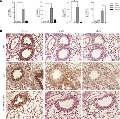 Streptococcus Pneumoniae Infection Triggers Il 20 Cytokine Expression