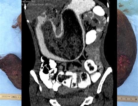 Whats Within This Stomach Can You Name Facebook