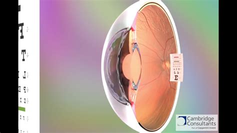 Ophthalmology Visioncare Accommodation Blender3d Luis Diaz Santana