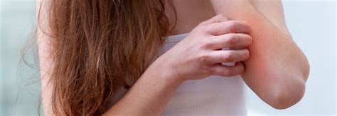 Atopic Dermatitis Vs Eczema What S The Difference