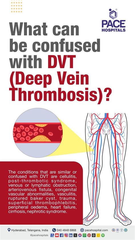 Deep Vein Thrombosis Dvt Symptoms Causes And Complications Artofit
