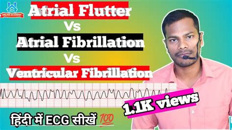 Af Atrial Flutter Atrial Fibrillation Ventricular Fibrillation Sinus Rhythm Arrhythmia
