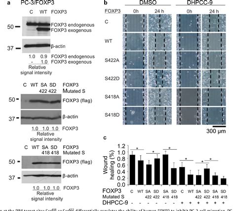Figure 3 From The Pim1 Kinase Promotes Prostate Cancer Cell Migration