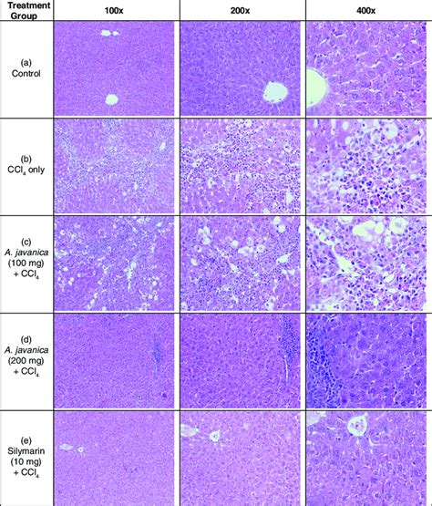 The Histopathology Of Experimental Rat Liver At 100 200 And 400