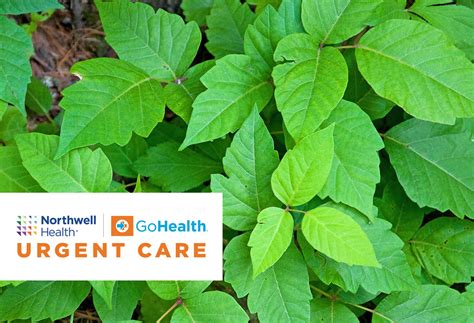 Poison Sumac Rash Contagious At Rebecca Castillo Blog