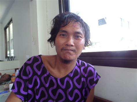 Maung Pay From Burma Raised 1500 To Fund Fracture Repair Watsi