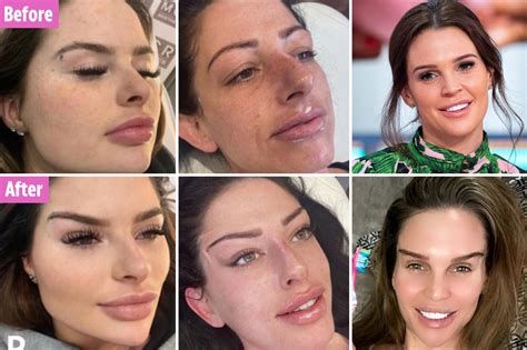 Fox Eye Surgery Is The New Big Trend Danielle Lloyd Loves But It
