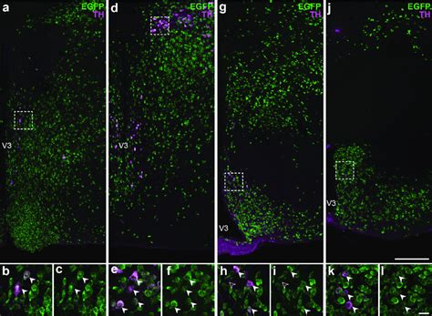Some Hypothalamic Catecholaminergic Neurons Are Gabaergic Download Scientific Diagram