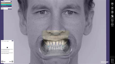 Exocad Viewer Exocad Dentalcad Smart Optics