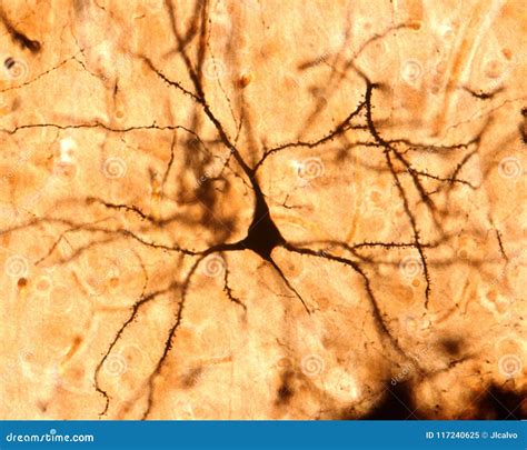 Pyramidal Cell Cerebral Cortex Stock Image Image Of Microscope Neurology 117240625