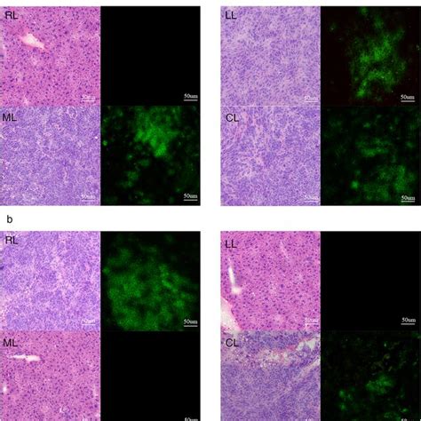 Mouse Liver Tissue Sections Under Blank And Fluorescent Vision ×100 Download Scientific