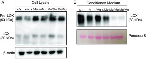Mutant Lox Is Retained Inside The Cell A Immunoblotting Of Mef Cell Download Scientific