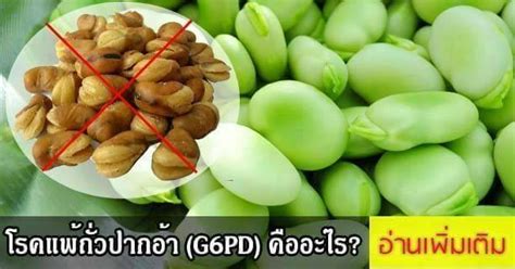 โรค G6pd หรือโรคแพ้ถั่วปากอ้า อาหารเสริมเพื่อสุขภาพ