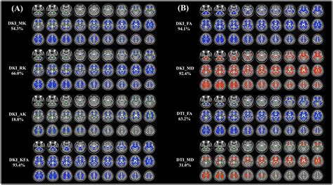 Diffusion And Functional Mri Reveal Microstructural And Network