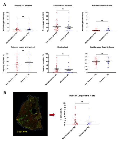 Impact Of Different Islet Invasion Patterns And β Cell Mass On Diabetes