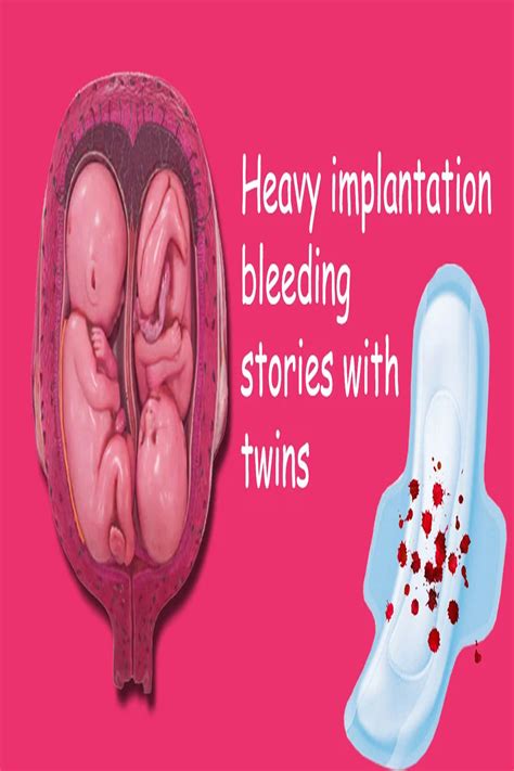Implantation Bleeding Artofit