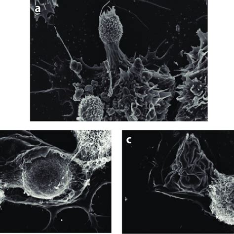 Histopathology Of Cryptococcus Neoformans Lung Infection Download
