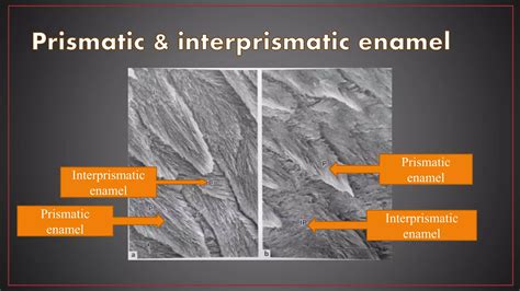 1st Bds Lecture On Tooth Enamel Pptx Dental Health Diseases And Conditions