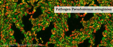 Calcium Induces Switch From Acute To Chronic Lung Infection