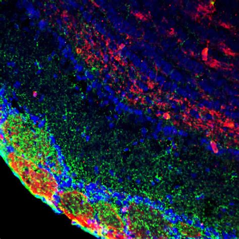 Multiplex Immunostaining Applications Of Atto Primary Conjugates